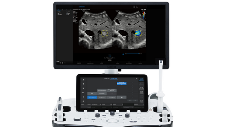 Präzise Leberdiagnostik mit dem neuen RS85 Prestige Ultraschallsystem ...