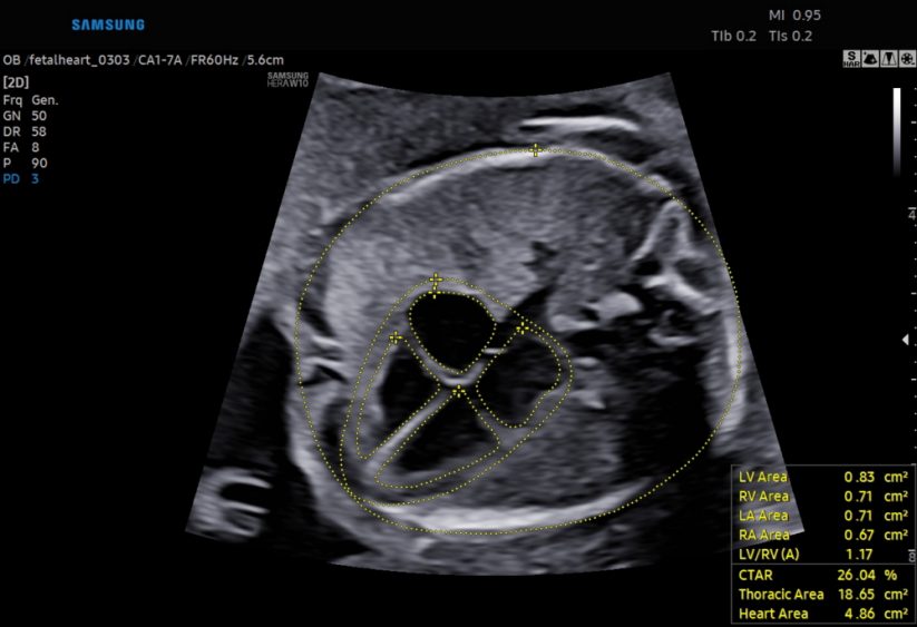 Samsung Presents Clinical Value of Its Enhanced Intelligent Assist ...